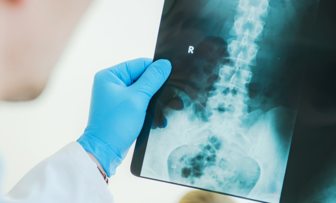 Imaging Markers - NL-Tec